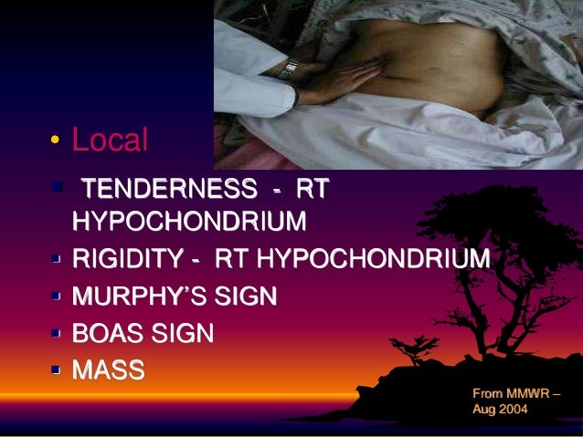 Acute cholecystitis..