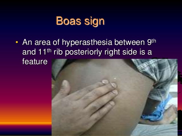 Acute cholecystitis..