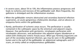Acute cholecystitis | PPTX