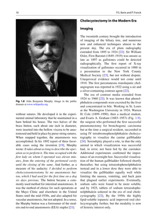 Acute cholecystitis | PDF