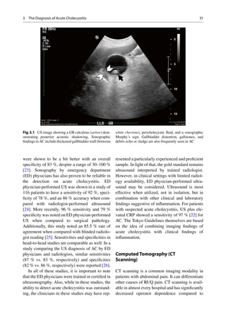 Acute cholecystitis | PDF