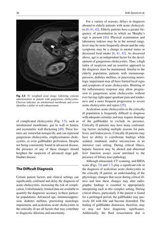 Acute cholecystitis | PDF