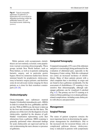 Acute cholecystitis | PDF
