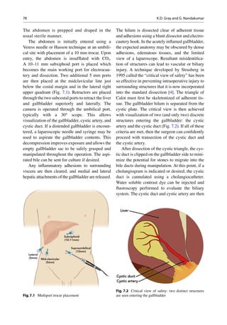 Acute cholecystitis | PDF