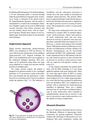 Acute cholecystitis | PDF