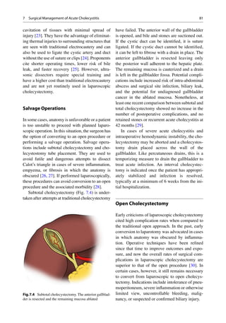 Acute cholecystitis | PDF