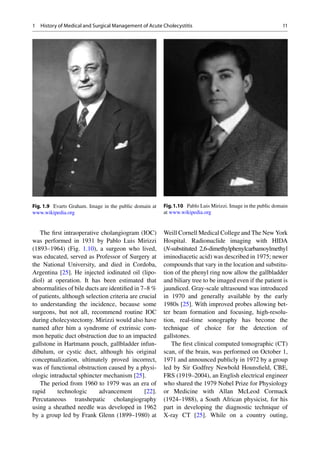 Acute cholecystitis | PDF