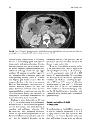 Acute cholecystitis | PDF