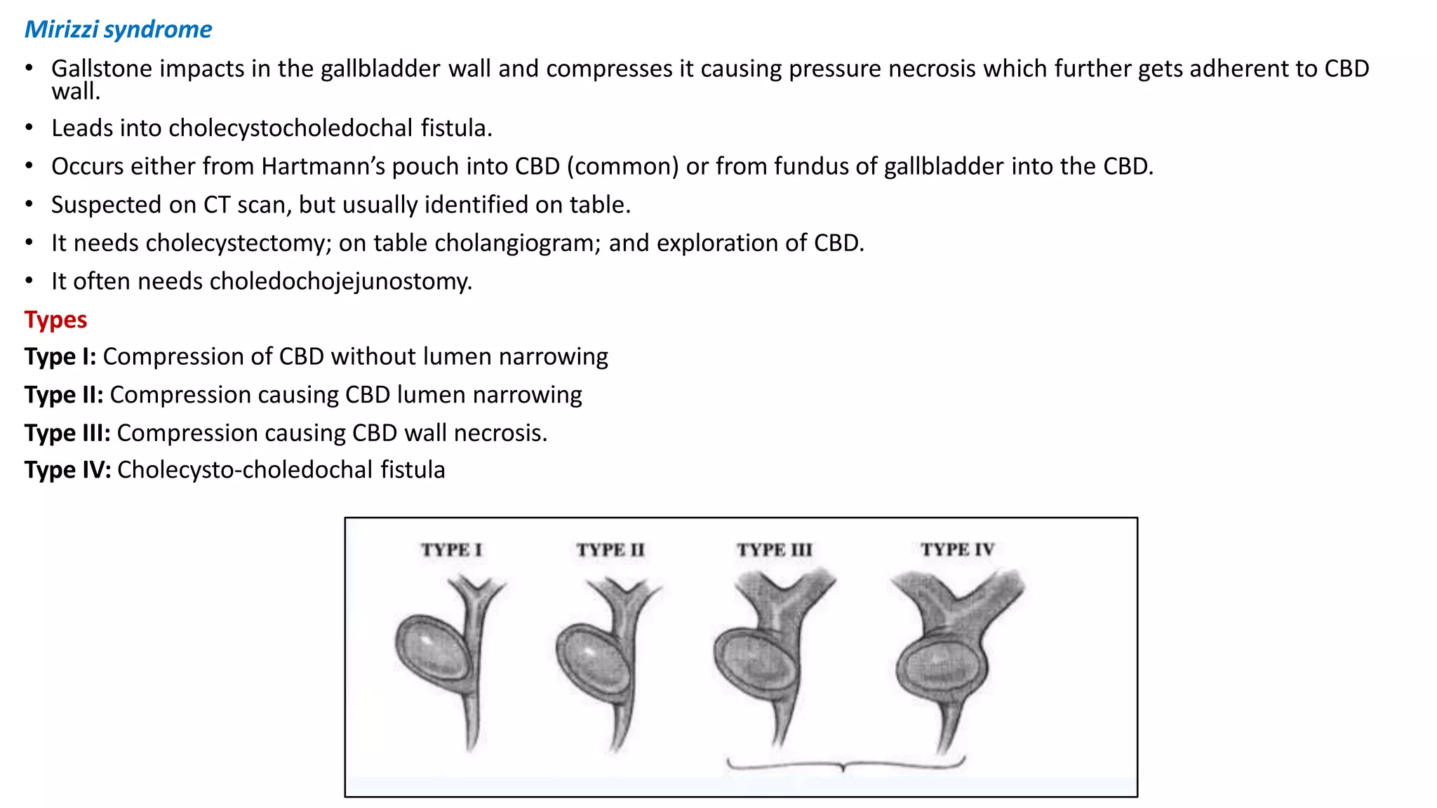 Acute cholecystitis.pptx