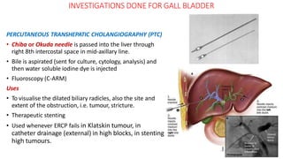 Acute cholecystitis.pptx