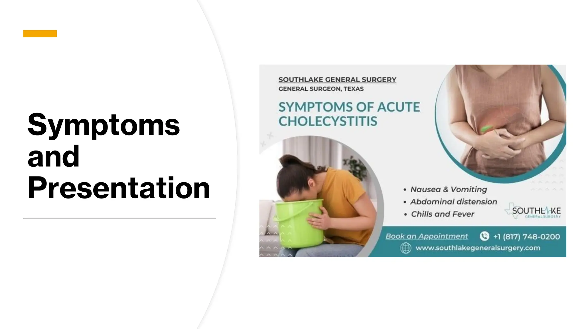 Acute Cholecystitis - Symptoms, Causes, & Treatment.pdf