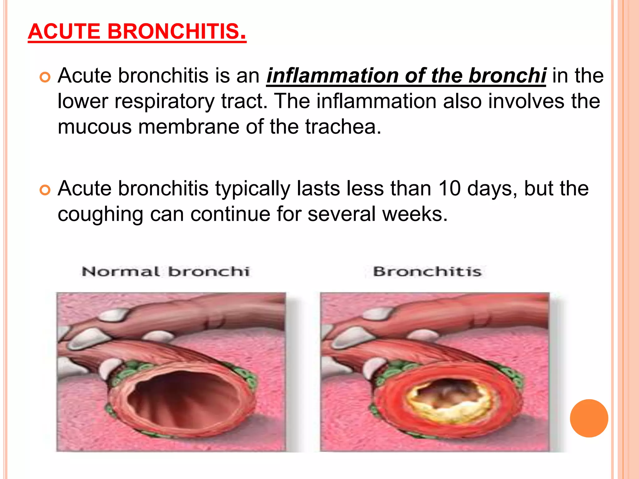 Acute and chronic Bronchitis & Nursing care | PPTX