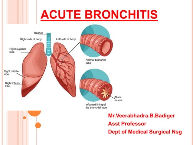 Acute and chronic Bronchitis & Nursing care | PPTX | Lung and Respiratory Health | Diseases and ...