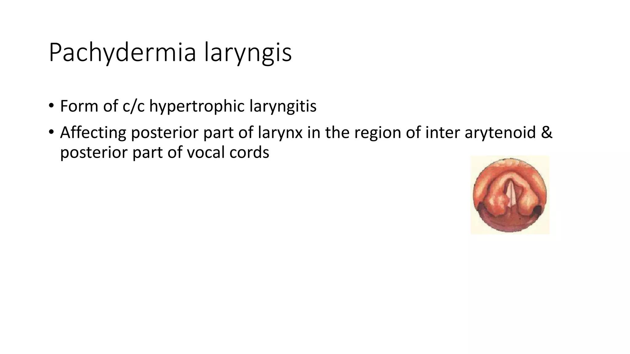Acute & chronic inflammations of larynx clinical features treatment ...