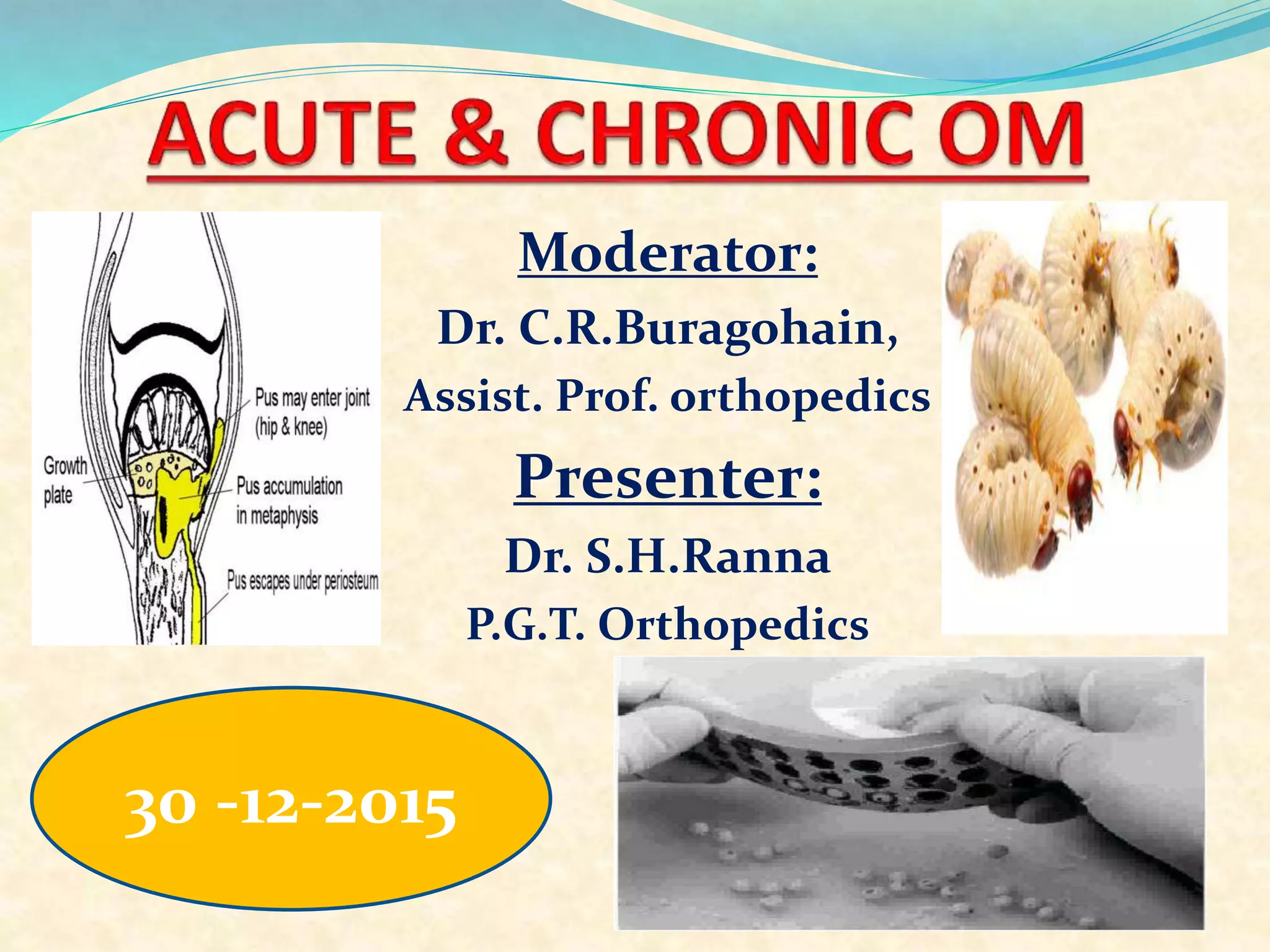 Acute & chronic om | PPTX | Bone and Joint Conditions | Diseases and ...