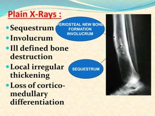 Acute & chronic om | PPT