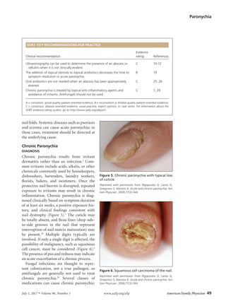 Onychia And Paronychia Of Toe