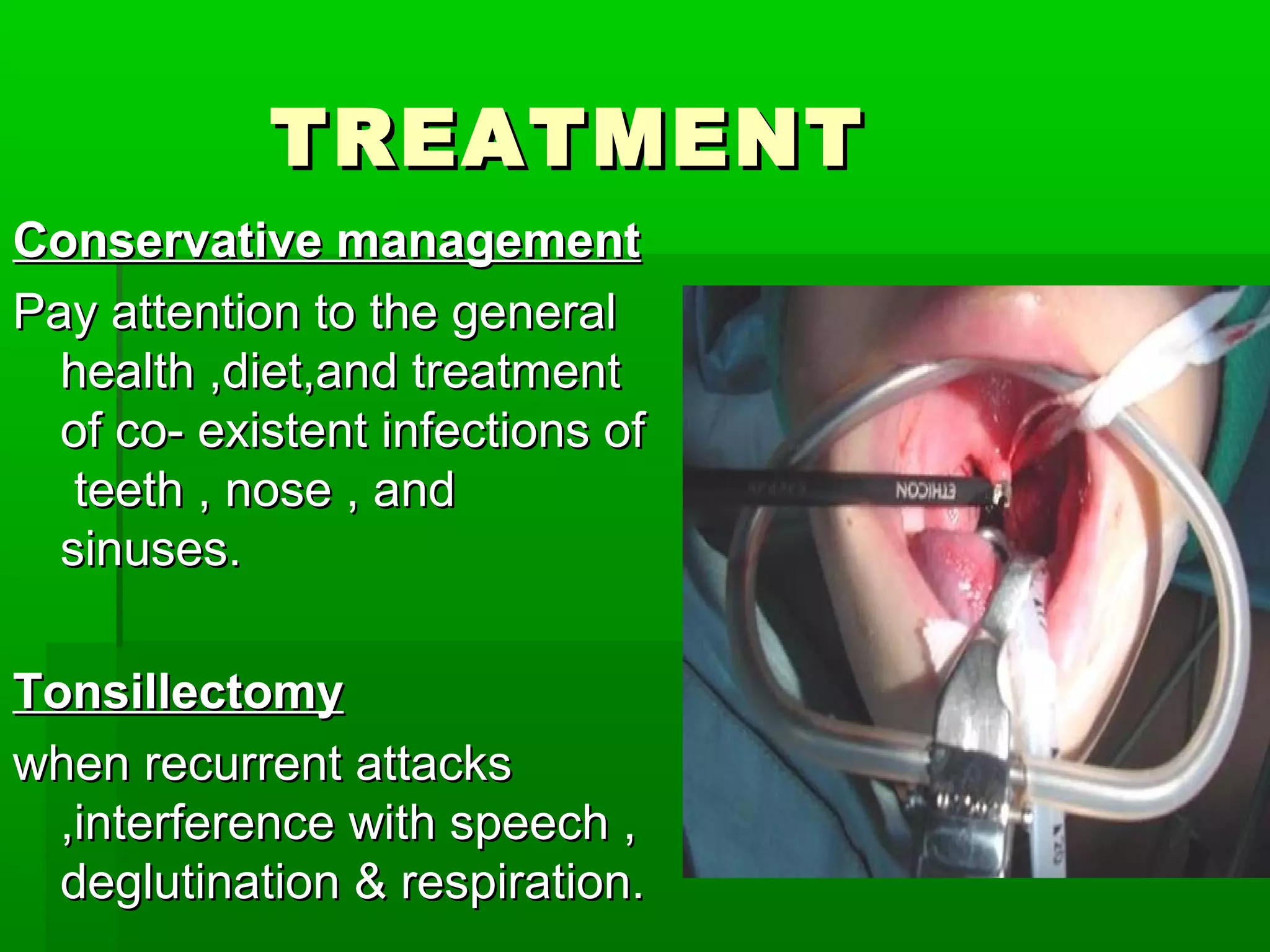 Acute & chronic tonsillitis and their management | PPT