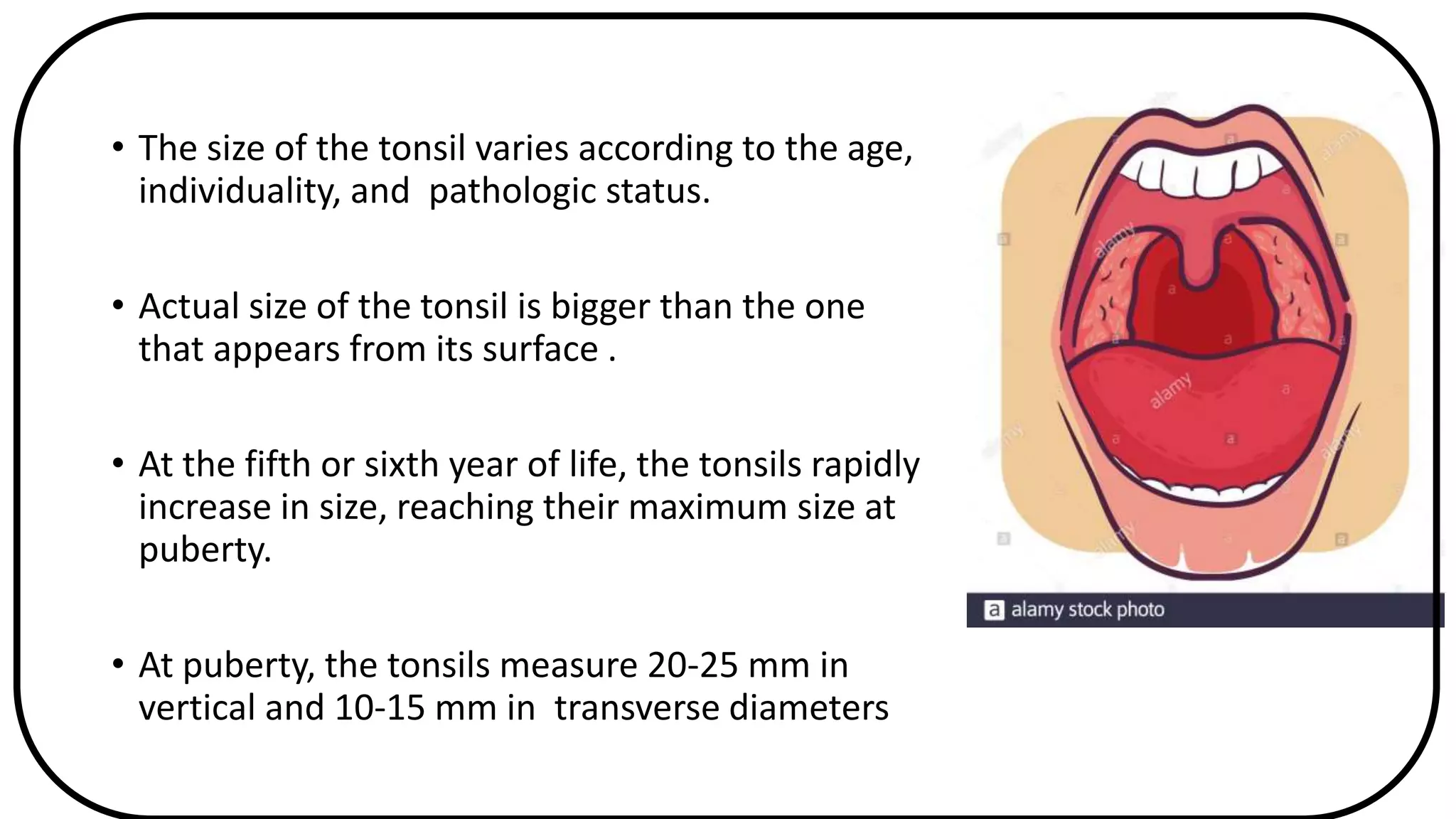 Acute and Chronic Tonsillitis | PPTX