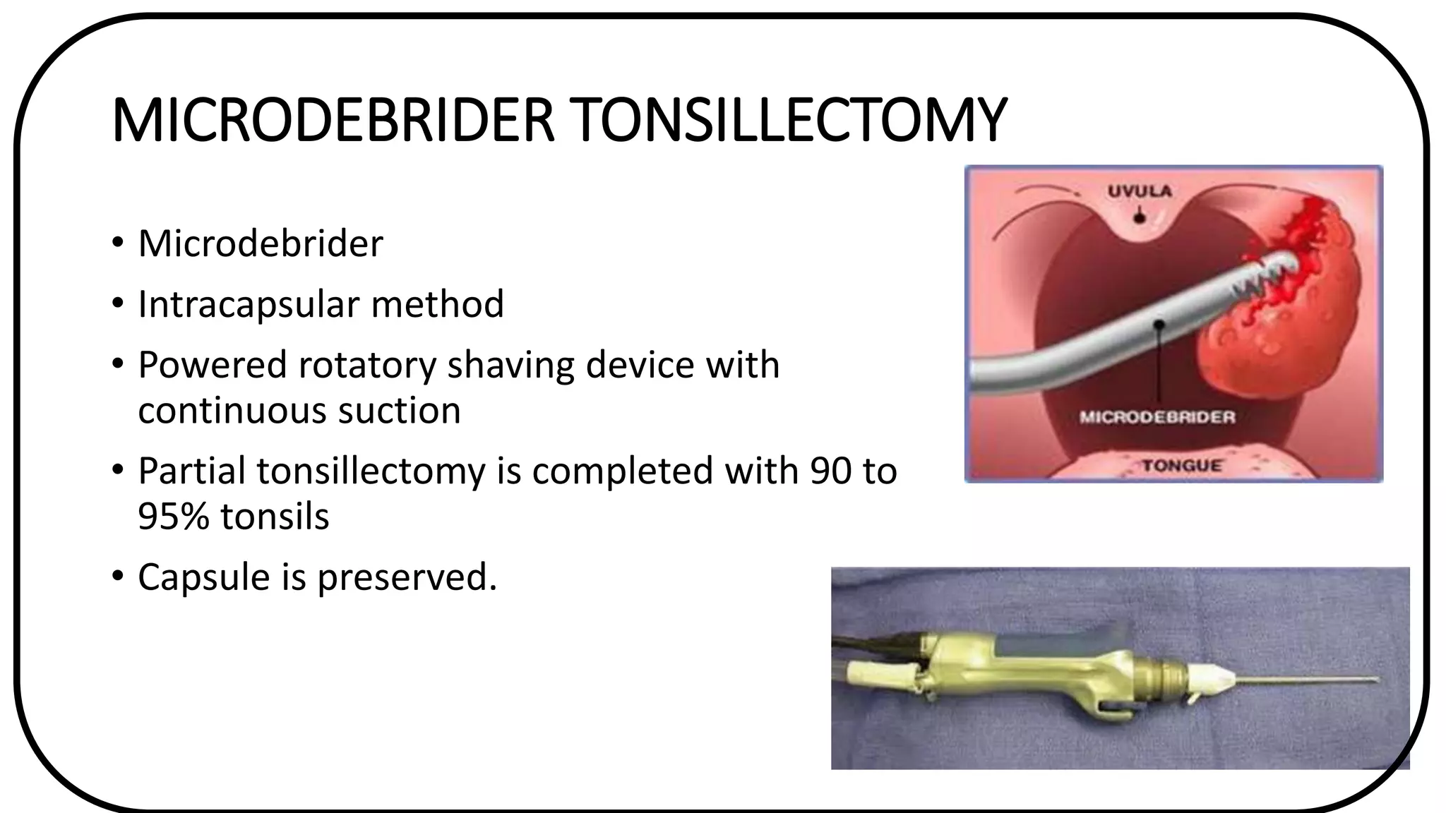 Acute and Chronic Tonsillitis | PPTX