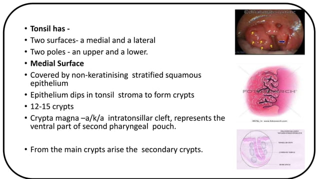 Acute and Chronic Tonsillitis | PPTX | Ear, Nose and Throat Conditions ...