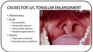 Acute and Chronic Tonsillitis | PPTX