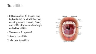 acute & chronic tonsillitis.pptx
