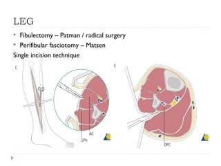 Acute compartment syndrome | PPT