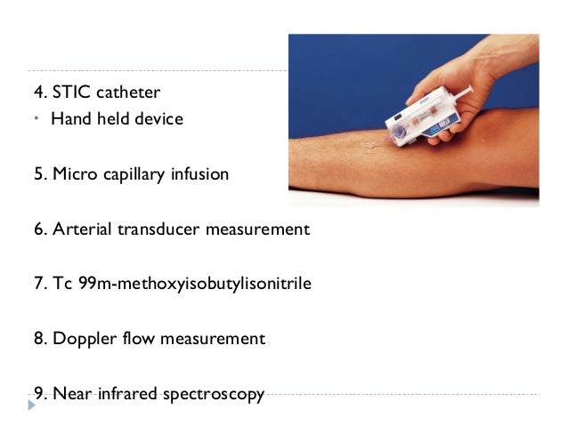 Acute compartment syndrome