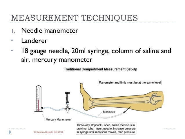 Acute compartment syndrome