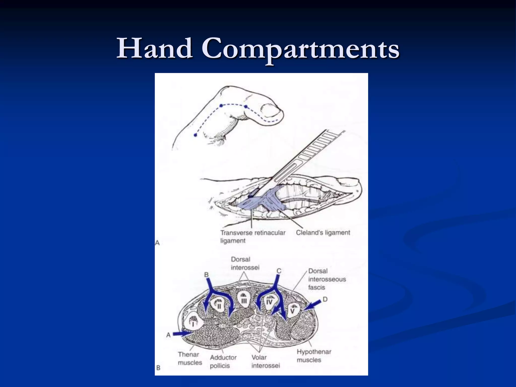 Acute compartment syndrome DR SANDEEP BHADOO | PPTX