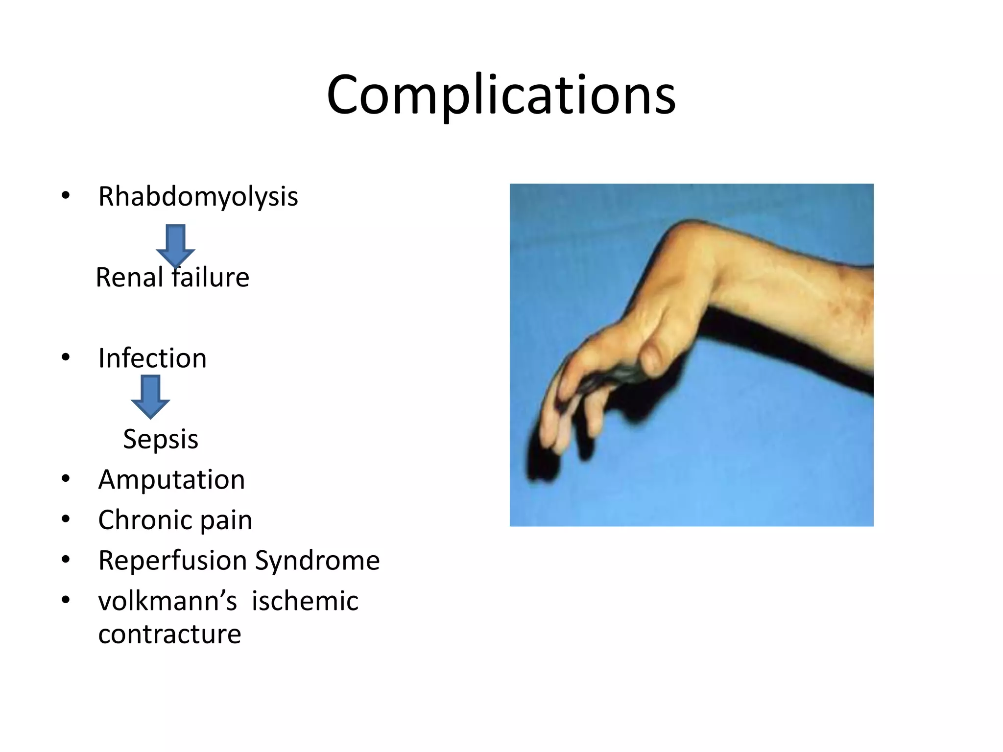 Acute compartment syndrome | PPTX
