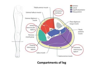 Acute compartment syndrome | PPTX