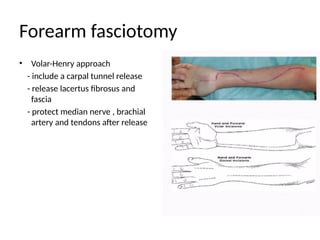 Acute compartment syndrome management.pptx