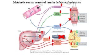 Acute Complications of Diabetes Mellitus | PPT