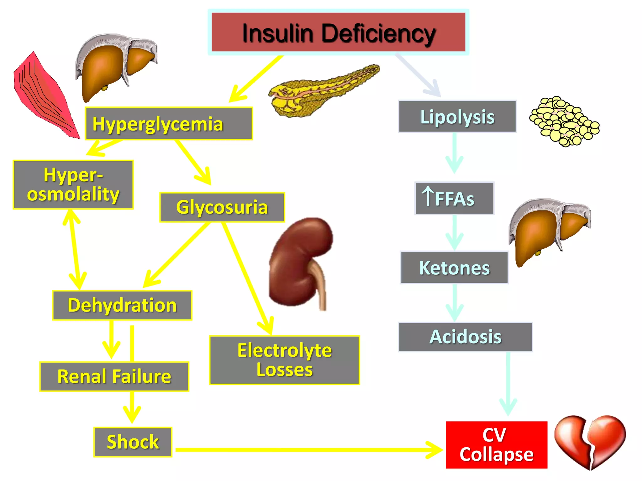 Acute complications of diabetes mellitus | PPTX