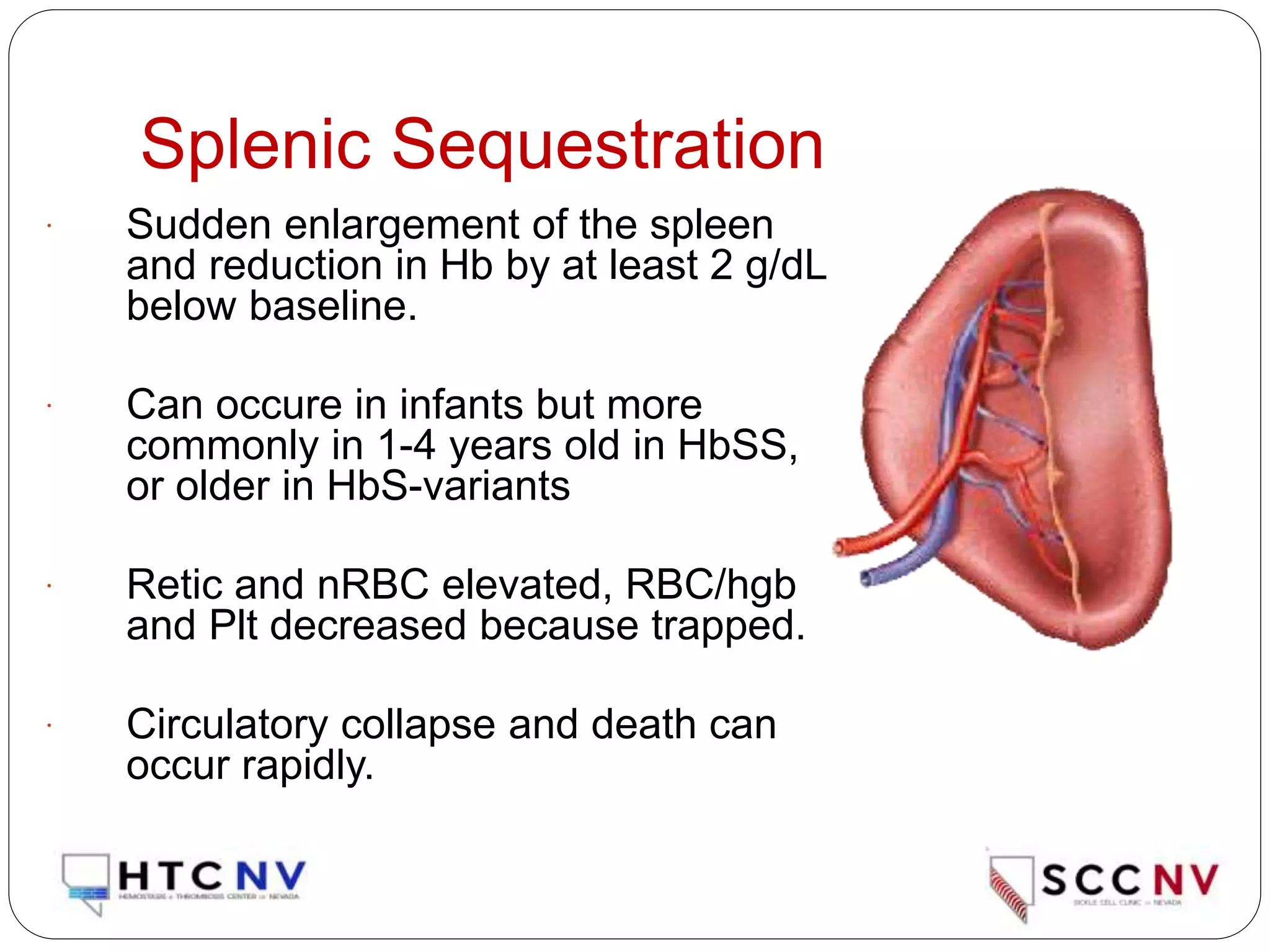 Acute Complications of SCD.pptx