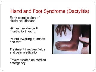 Acute Complications of SCD.pptx