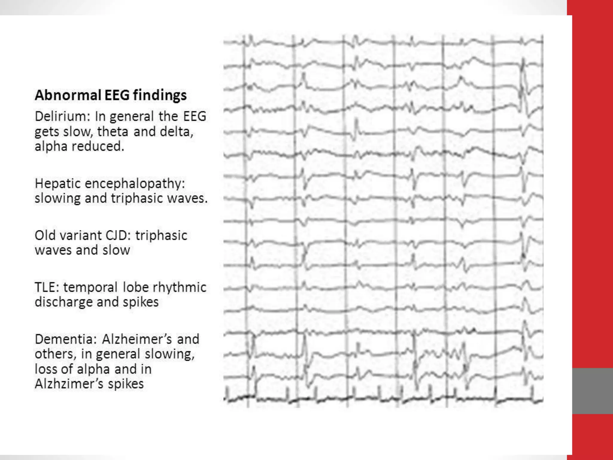 Acute confusional state | PPTX