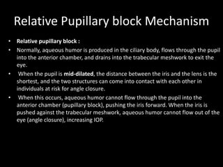 primary closed angle glaucoma (Acute congestive glaucoma) | PPTX