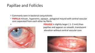ACUTE CONJUNCTIVITIS pptn.pptx
