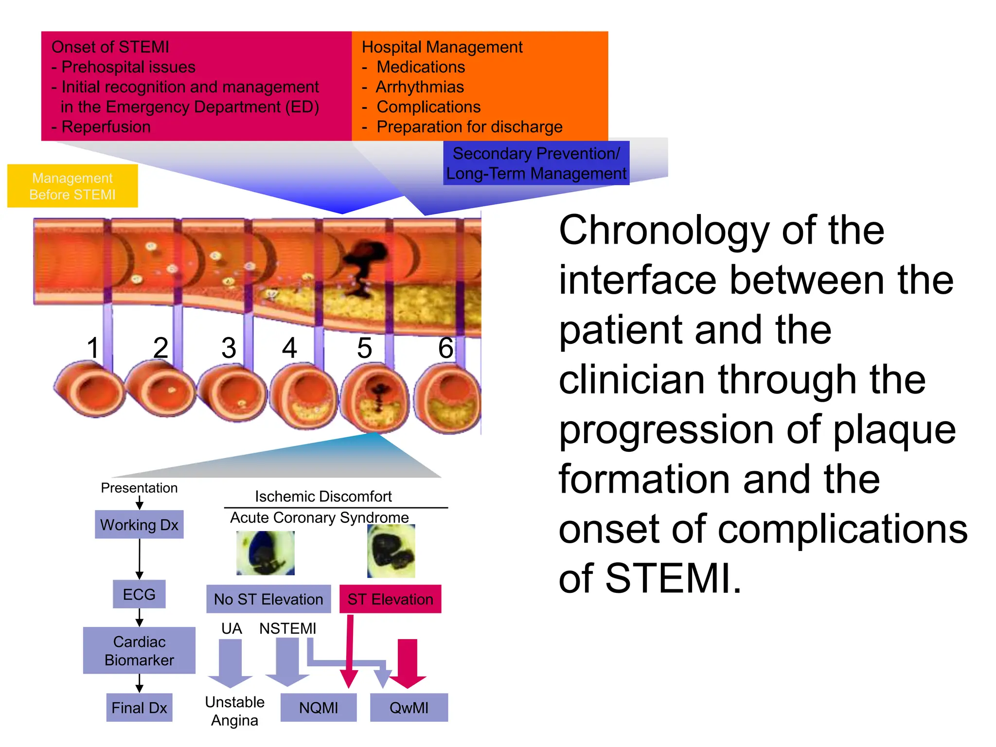 Acute coronary.ppt.Acute Coronary Syndrome | PPT