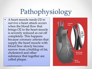 Acute coronary syndrom | PPTX