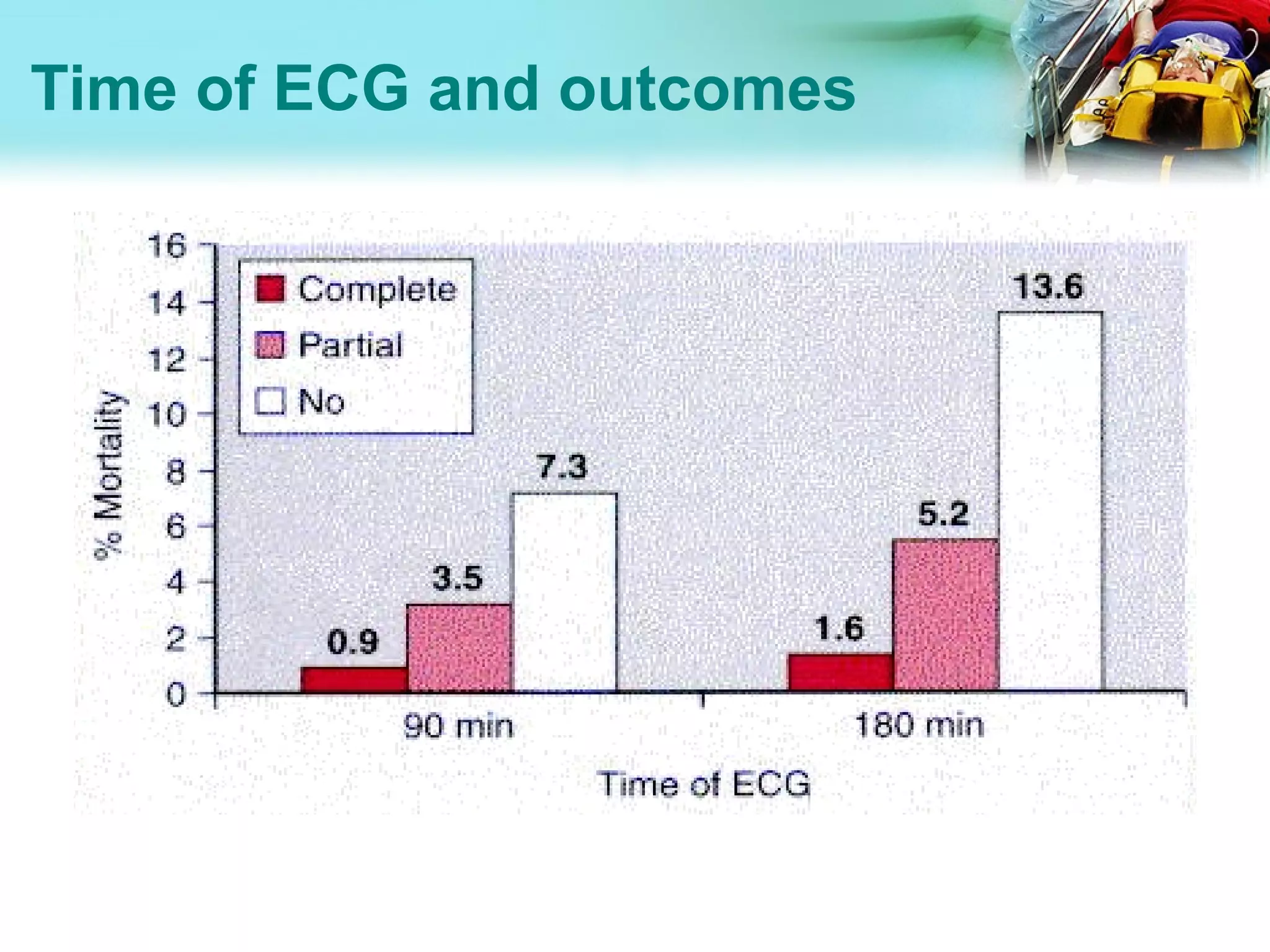 Acute coronary syndrome | PPT