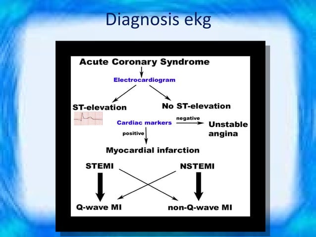 Acute coronary syndrome | PPT