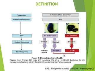 Acute coronary syndrome | PPT