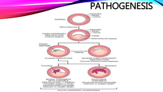 Acute Coronary Syndrome (ACS), Medicine | PPTX