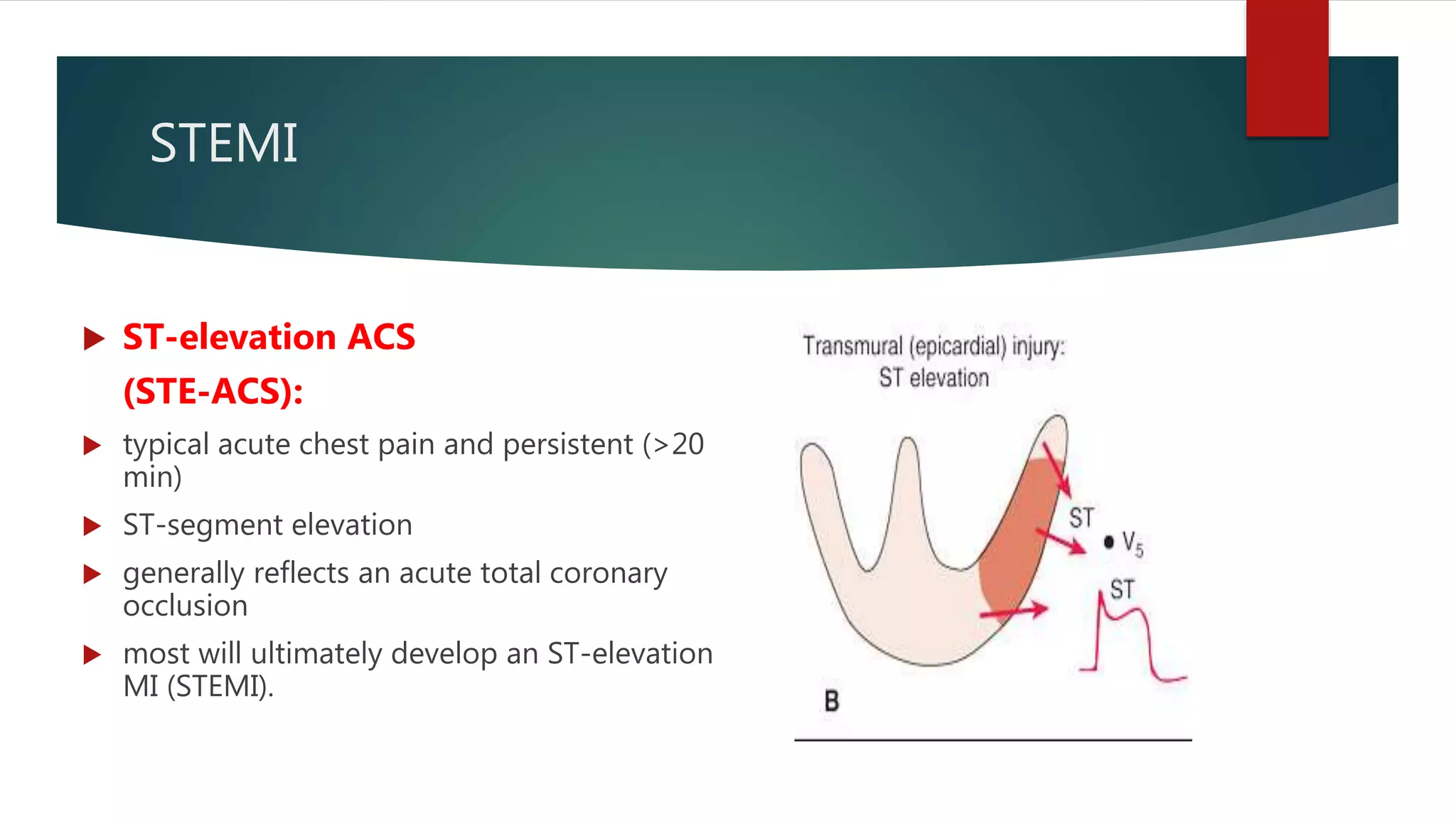 Acute coronary syndrome | PPTX