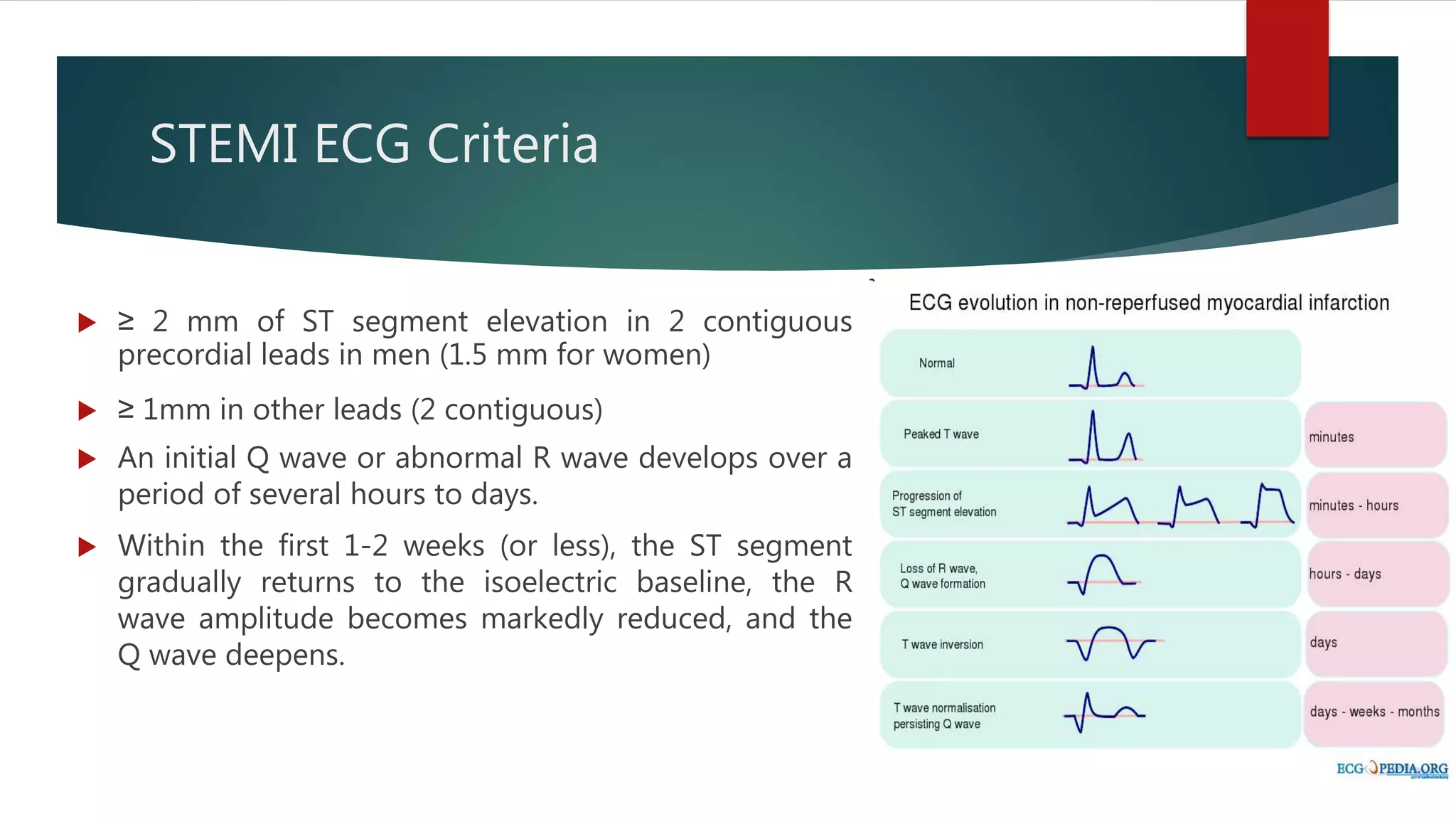Acute coronary syndrome | PPTX