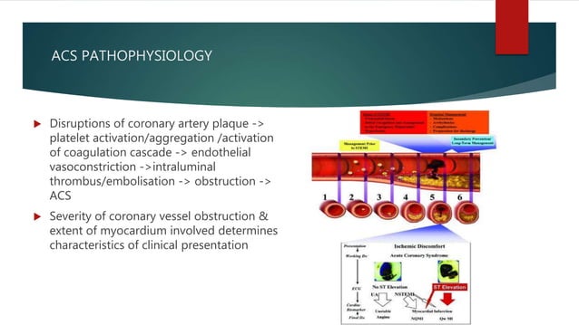 Acute coronary syndrome | PPT